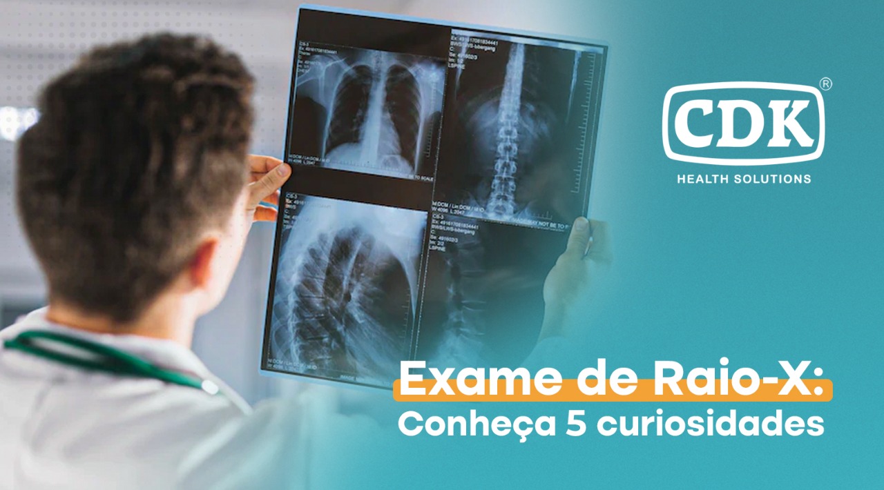 Exame de Raio-X: Conheça 5 curiosidades - CDK - Equipamentos de Raio-X