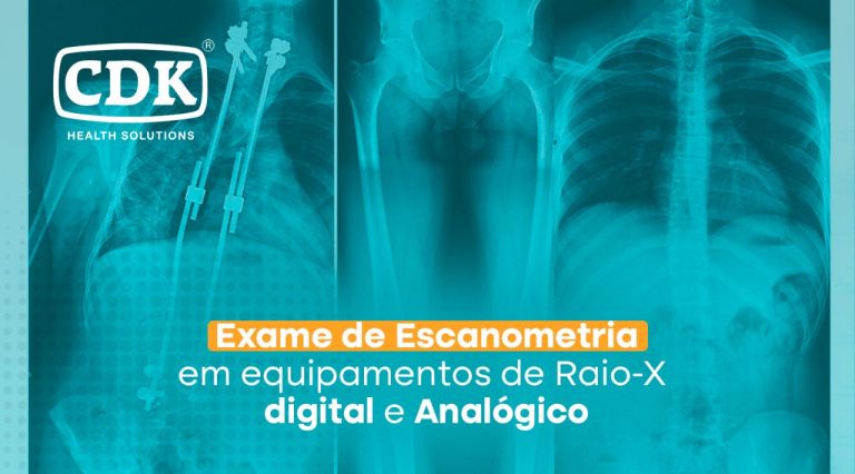 Exame de Escanometria em equipamentos de Raio-X digital e Analógico – CDK